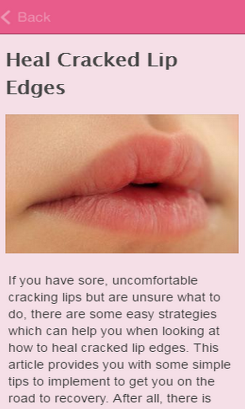 How To Heal Cracked Lips: Amazon.ca: Appstore for Android