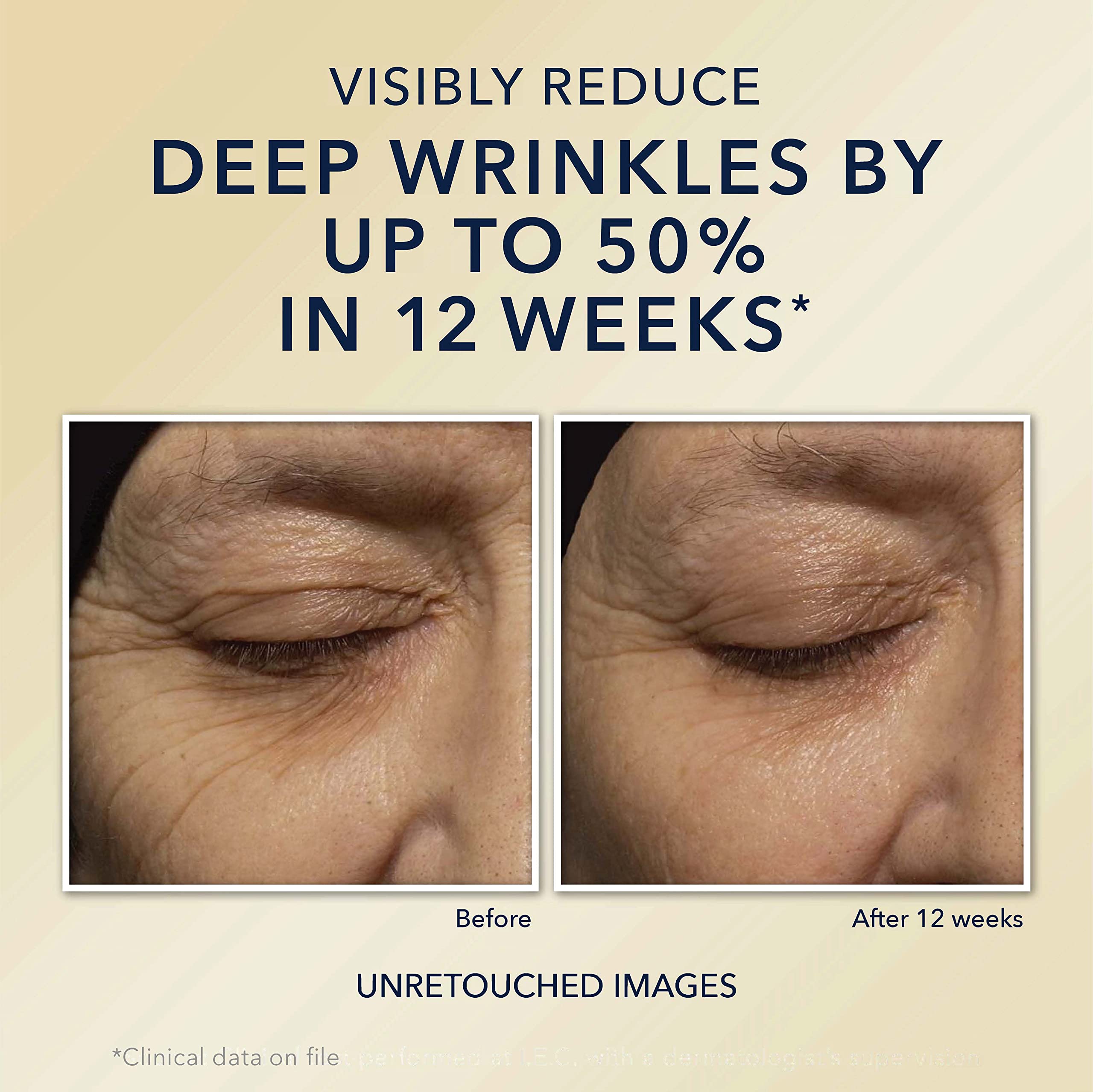 Mua RoC Retinol Correxion Deep Wrinkle Anti-Aging Night Cream, Daily ...