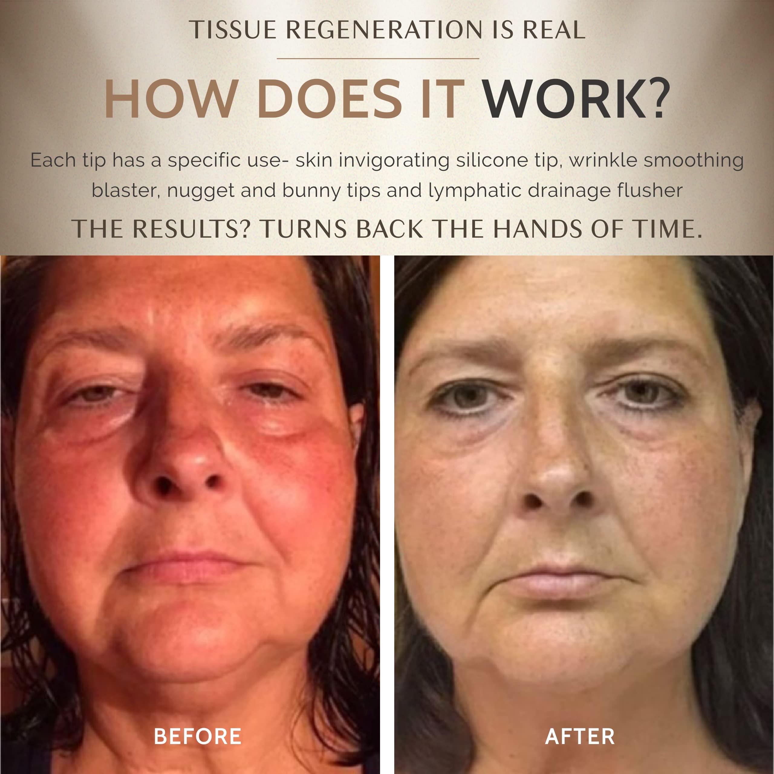 Mua The OMG Blaster 5-in-1 Face Lifting Tool by Ashley Black. Patented ...