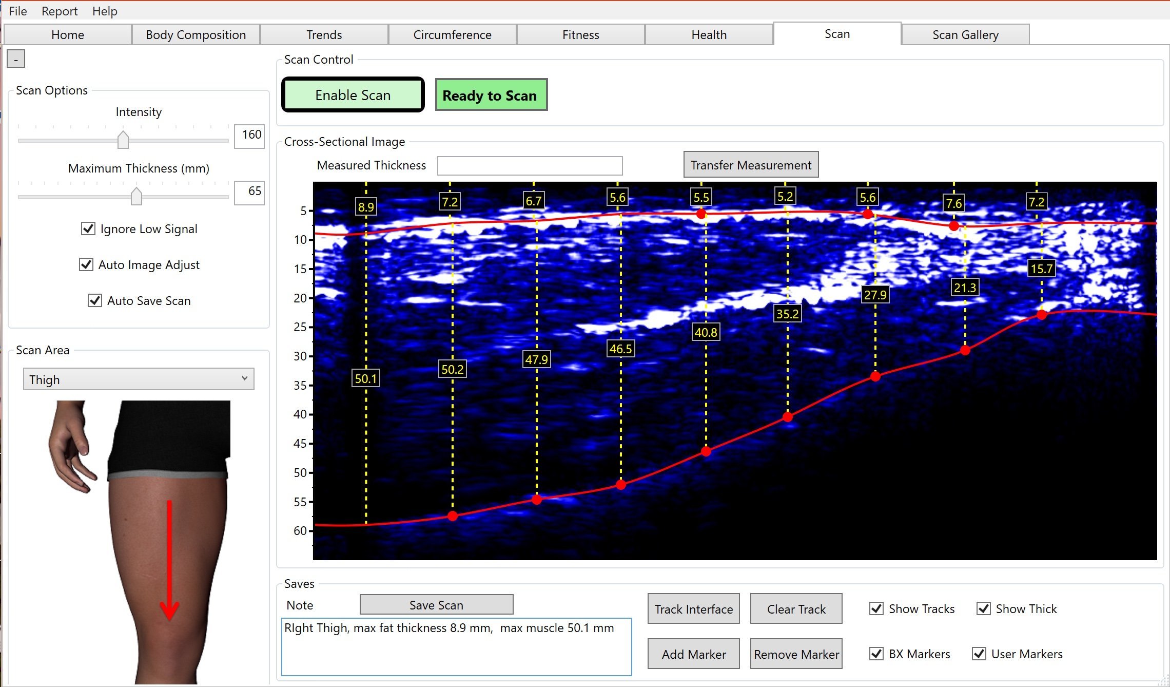 Mua BodyMetrix Professional Ultrasound Body Composition trên Amazon Mỹ chính hãng 2024 | Fado