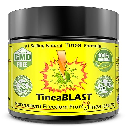 Tinea Versicolor Cream FAST Relief than soap, Body wash, Lotion ...