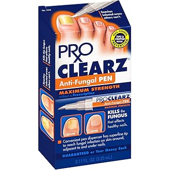 Amazon.com: PROCLEARZ Fungi-Cide PM Anti-fungal Cream, 0.9 oz: Health ...