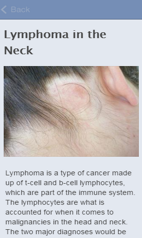 Amazon.com: Symptoms Of Lymphoma : Apps & Games