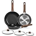 Amazon.com: Frying Pan Set With Lids - Non Stick Frying Pans Set 3 Pcs ...