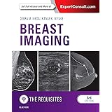 Breast Imaging: The Core Requisites: 9780323758499: Medicine & Health ...