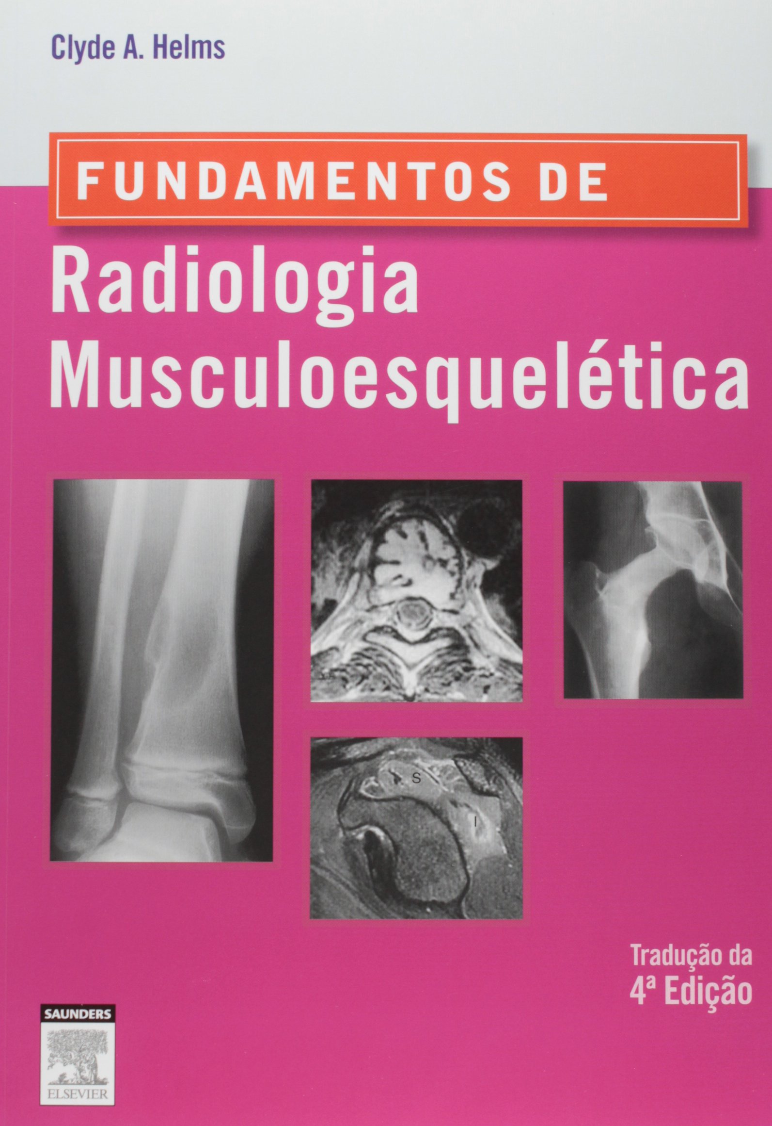 Fundamentos de Radiologia Musculoesquelética PDF Clyde A. Helms