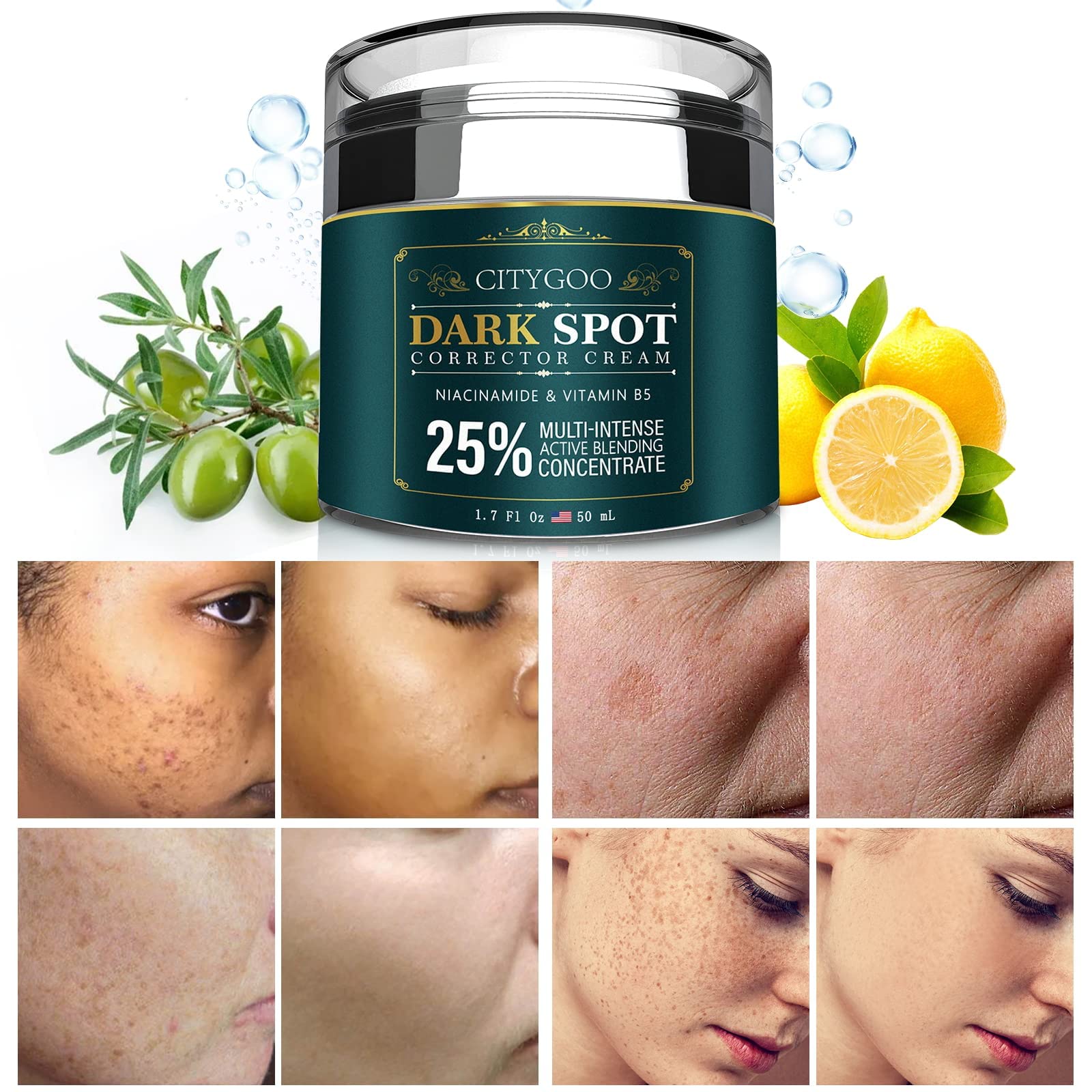 Mua CITYGOO Dark Spot Remover for Face and Body, Corrector Cream ...
