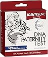 Amazon.com: STK Paternity Test Kit - Includes All Lab Fees: Health ...