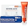 Amazon.com : Acne Free Terminator 10 Acne Spot Treatment with Benzoyl ...
