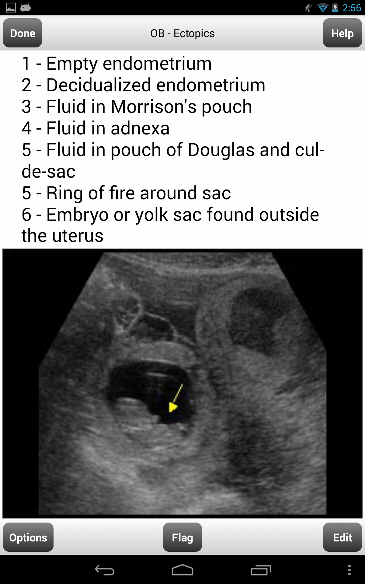 Amazon.com: ARDMS OBGYN Ultrasound Flashcards for ARDMS OB/GYN Board ...