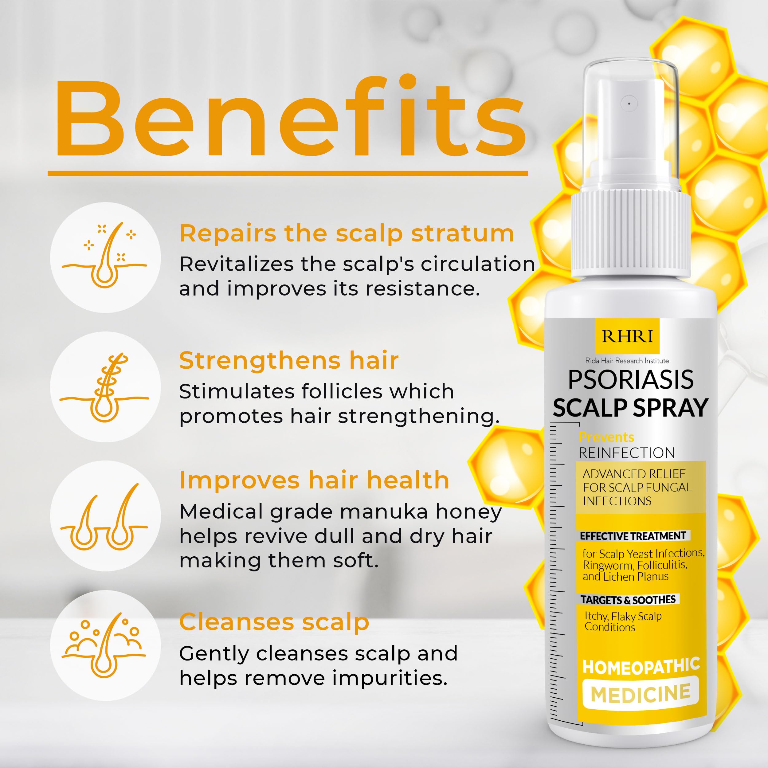 Mua Psoriasis Scalp Treatment Spray – Anti-Itch, Anti-Fungal Scalp ...