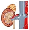 P9IDEDFH Anatomical Model Human Urinary System Model Kidney Ureter ...