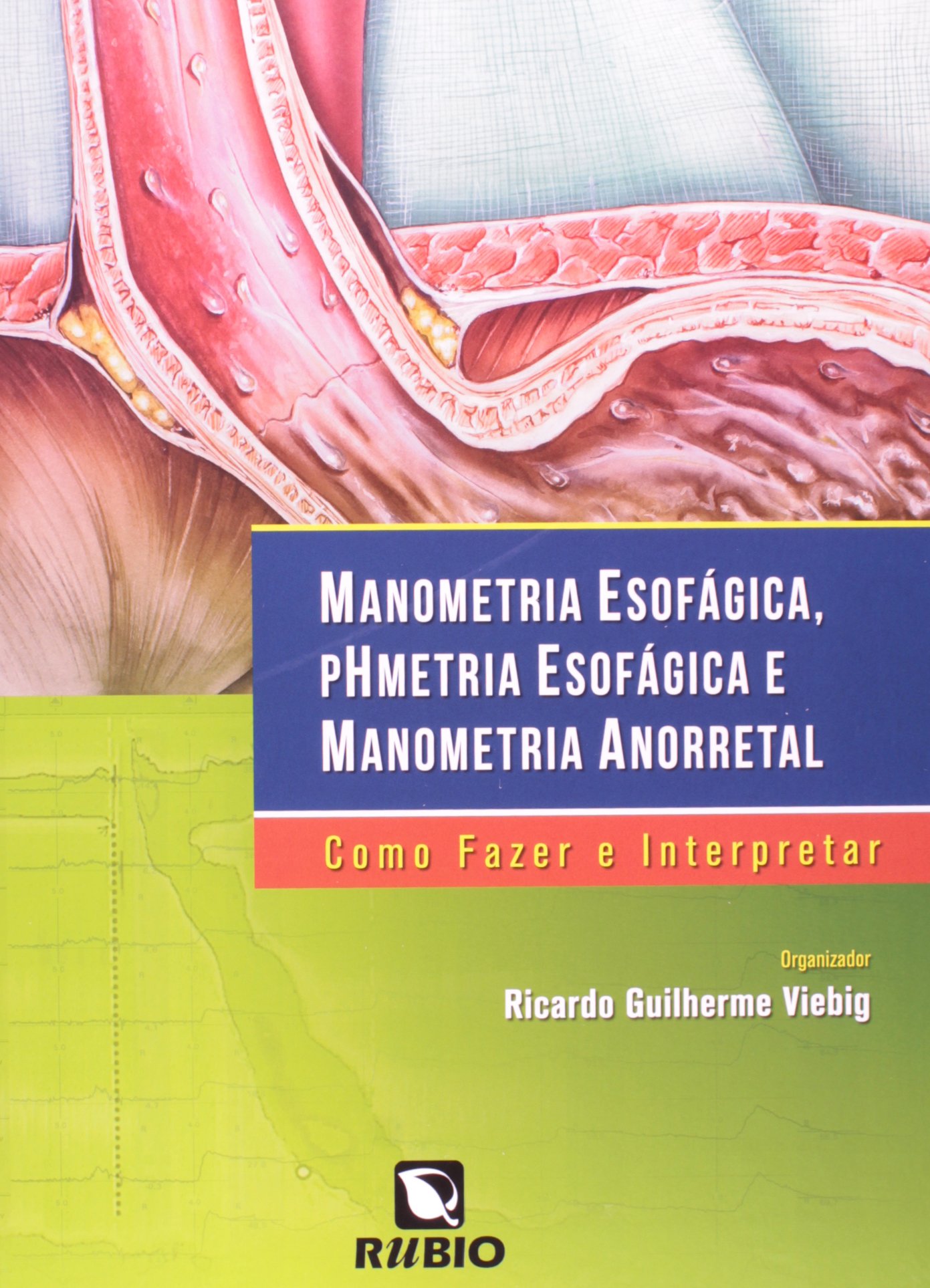 Manometria Esofágica, Phmetria Esofágica e Manometria Anorretal. Como ...
