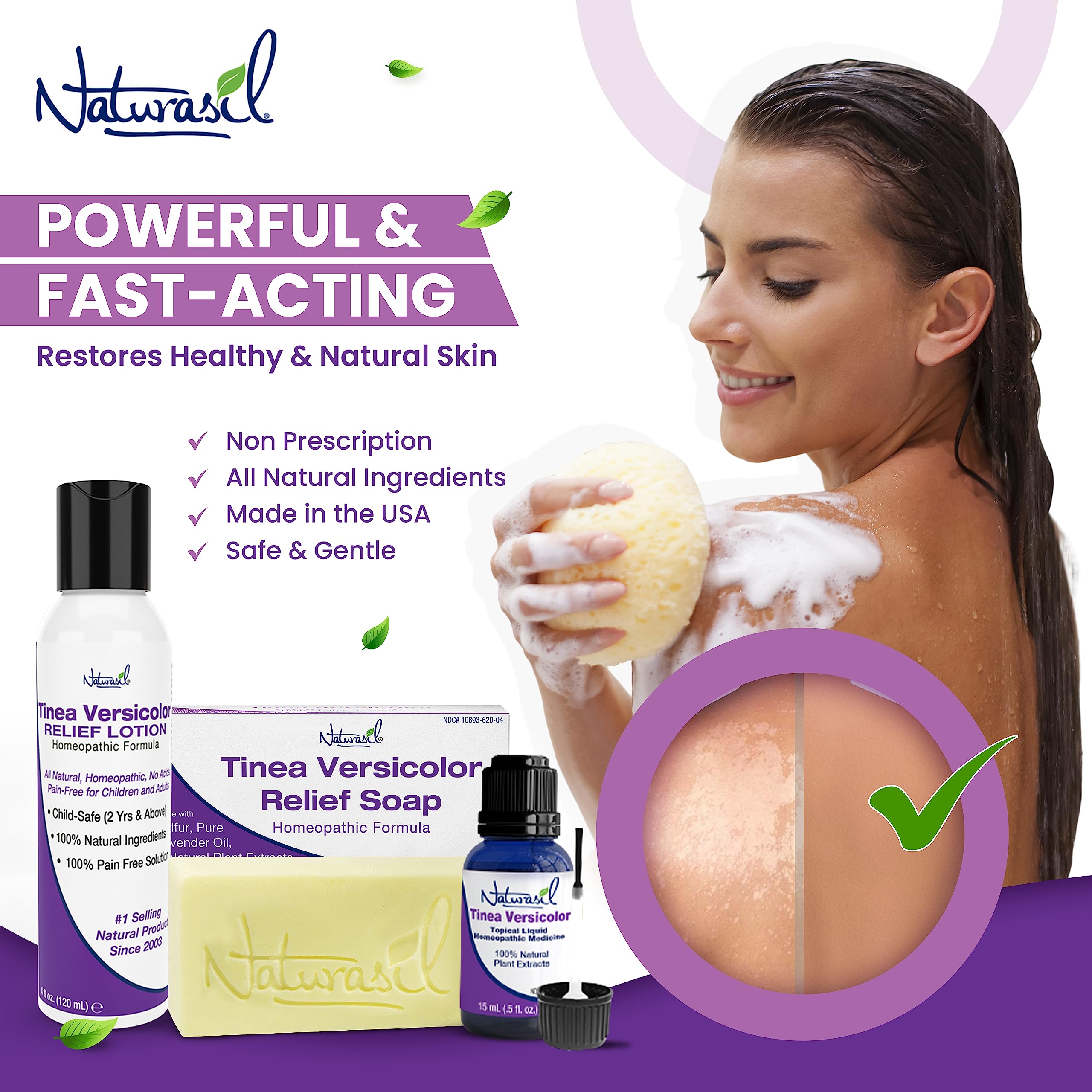 Mua Naturasil Powerful Tinea Versicolor Treatment - Fast-Acting Tinea ...