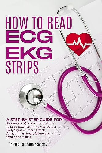 How to Read EKG/ECG Strips: A Step-By-Step Guide for Students to ...
