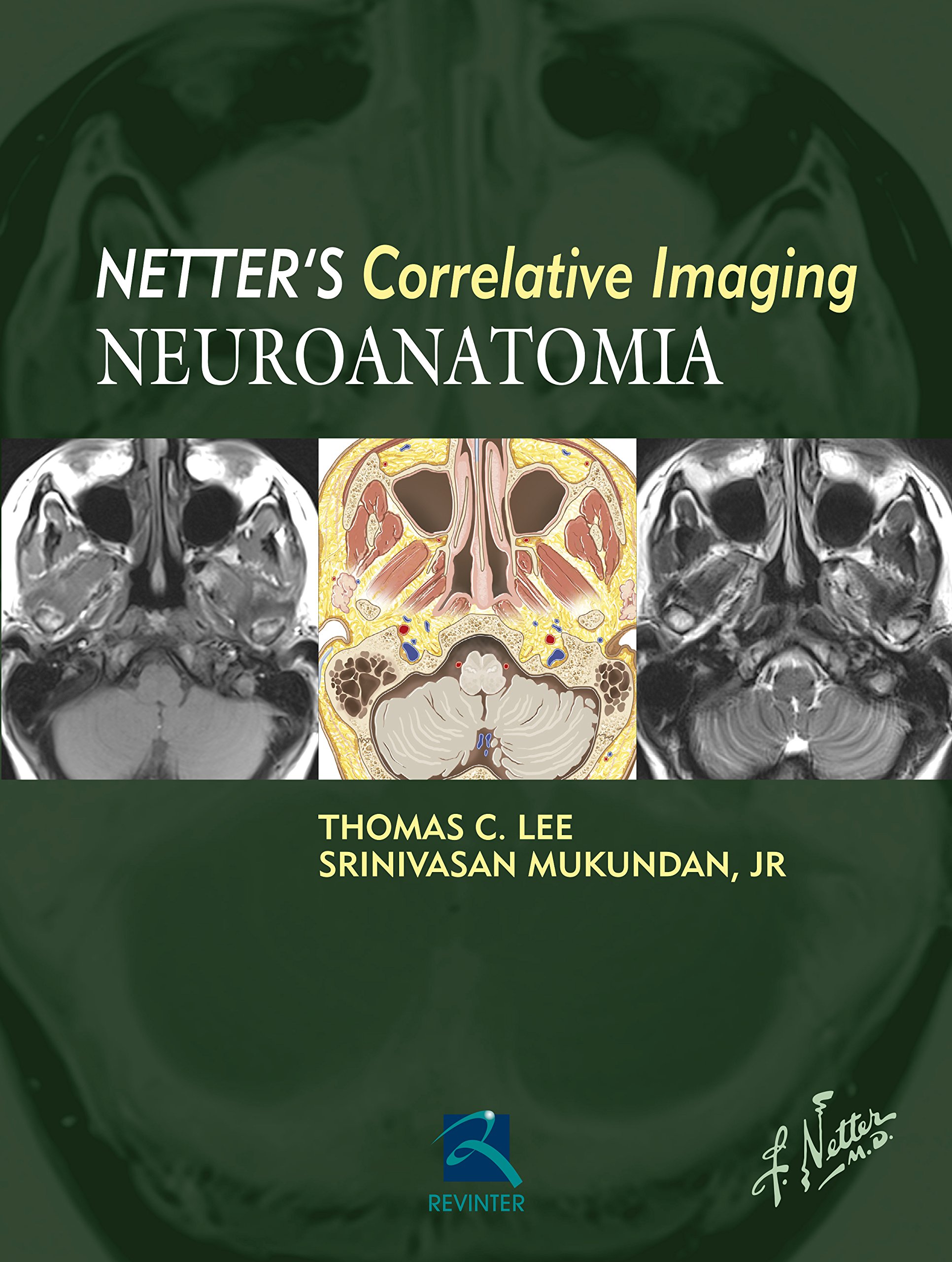 Netter's Correlative Imaging - Neuroanatomia PDF Thomas C. Lee ...