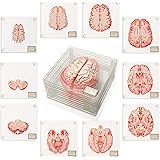 Amazon.com: Anatomic Heart Specimen Coasters (Set of 6 Pieces) - Brain ...