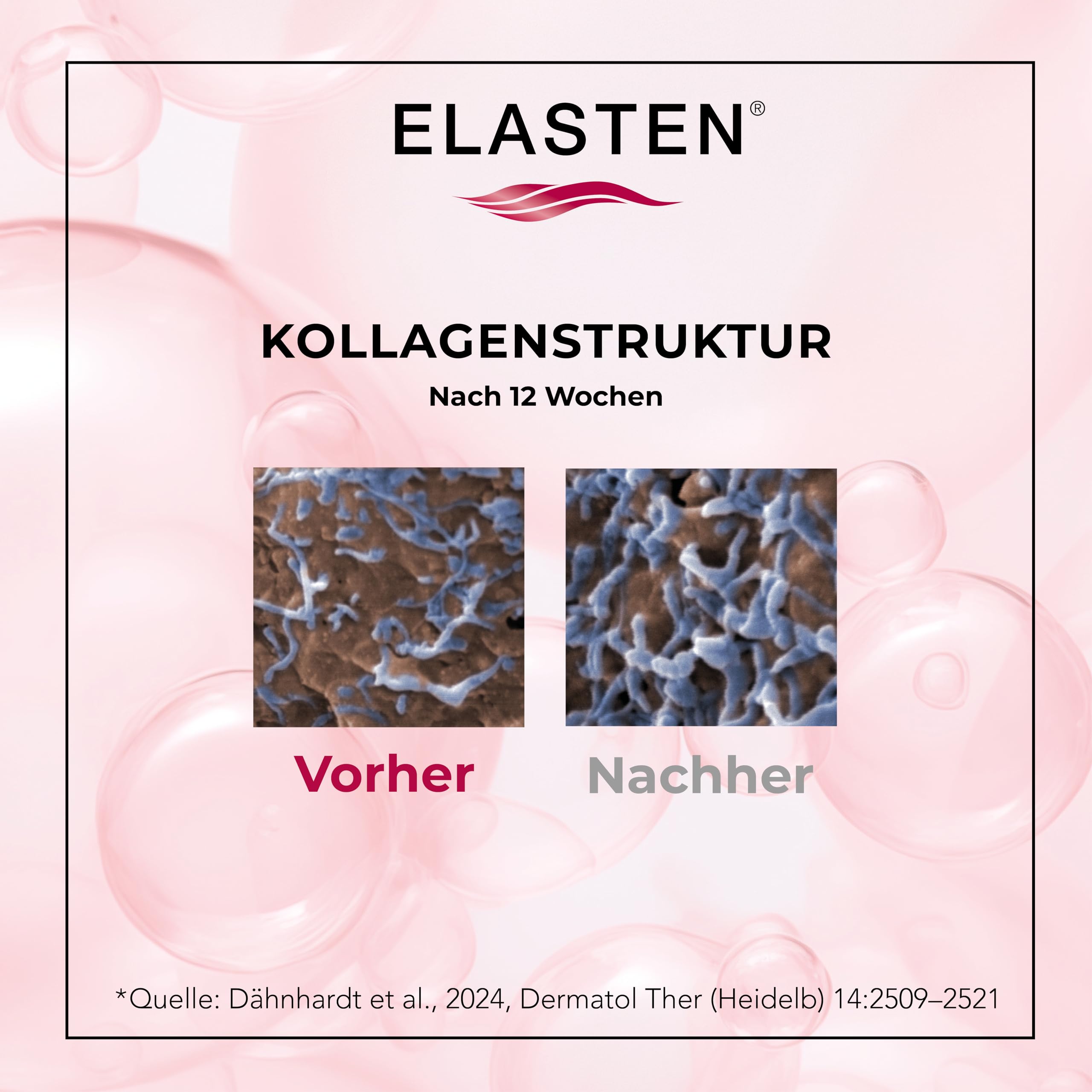 Mua ELASTEN - Der studiengeprüfte Kollagen-Komplex für strahlende Haut ...