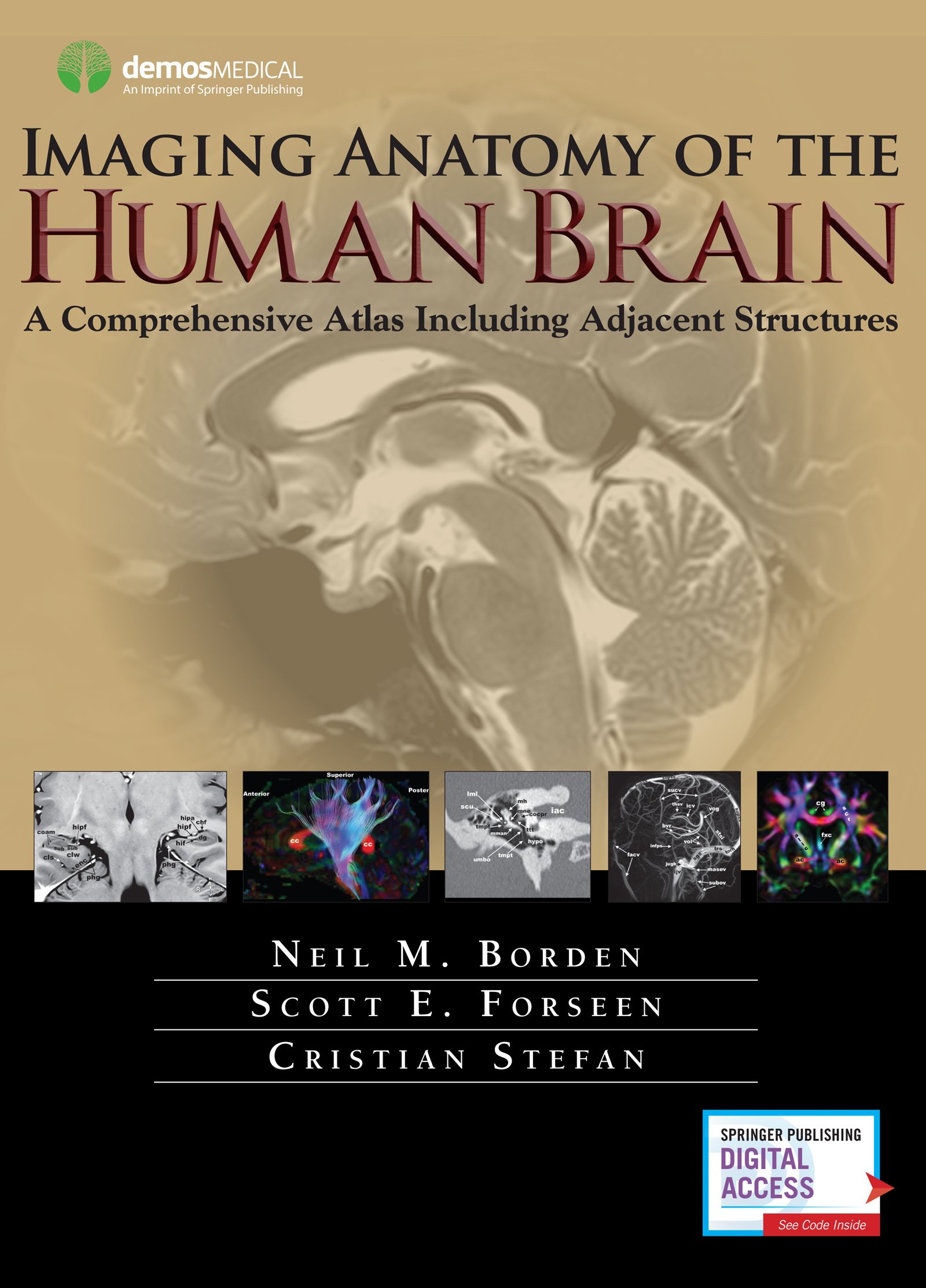 Mua Imaging Anatomy of the Human Brain: A Comprehensive Atlas Including ...