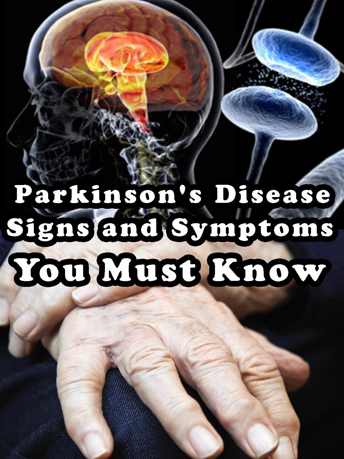 Watch Parkinson's Disease - Signs and Symptoms You Must Know | Prime Video
