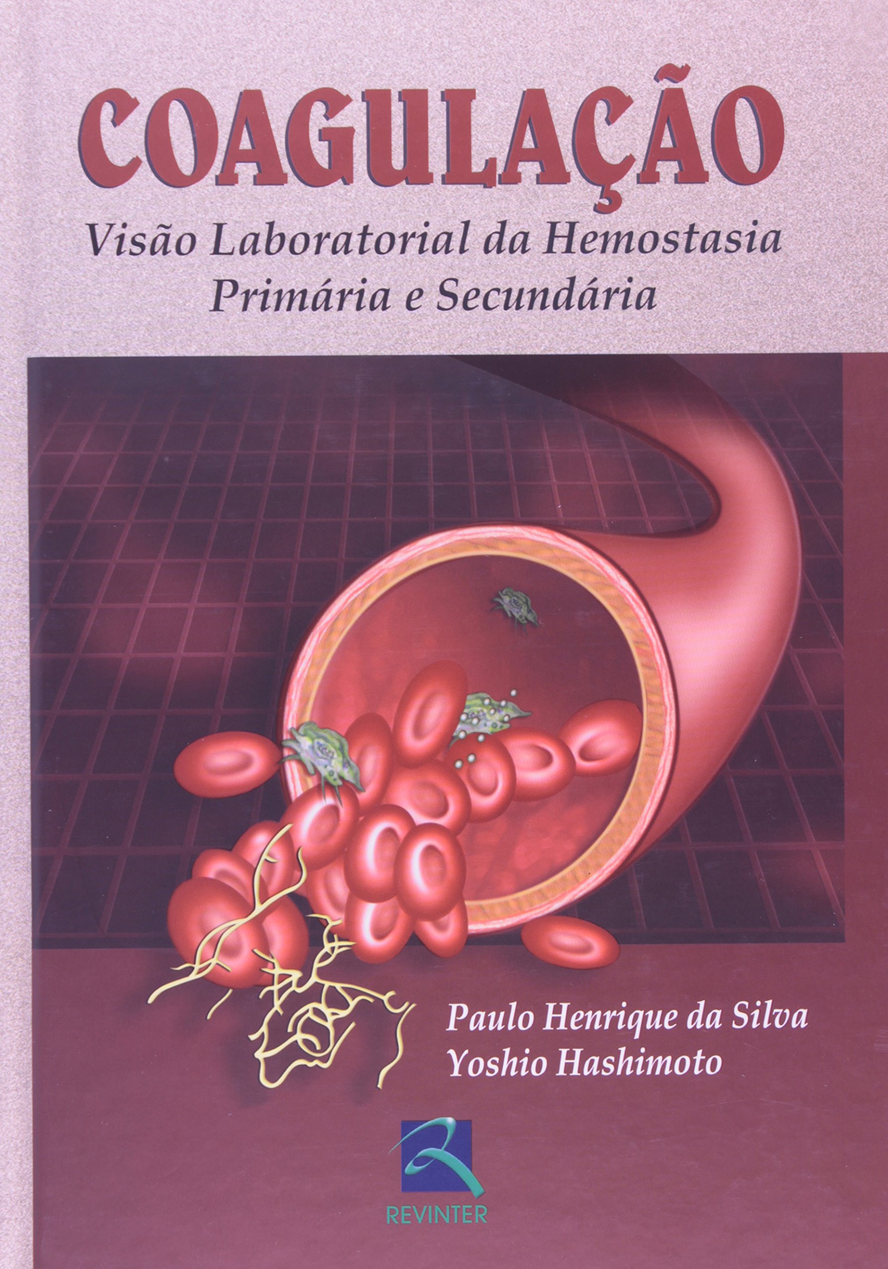 Coagulação. Visão Laboratorial Da Hemostasia Primaria E Secundaria PDF ...