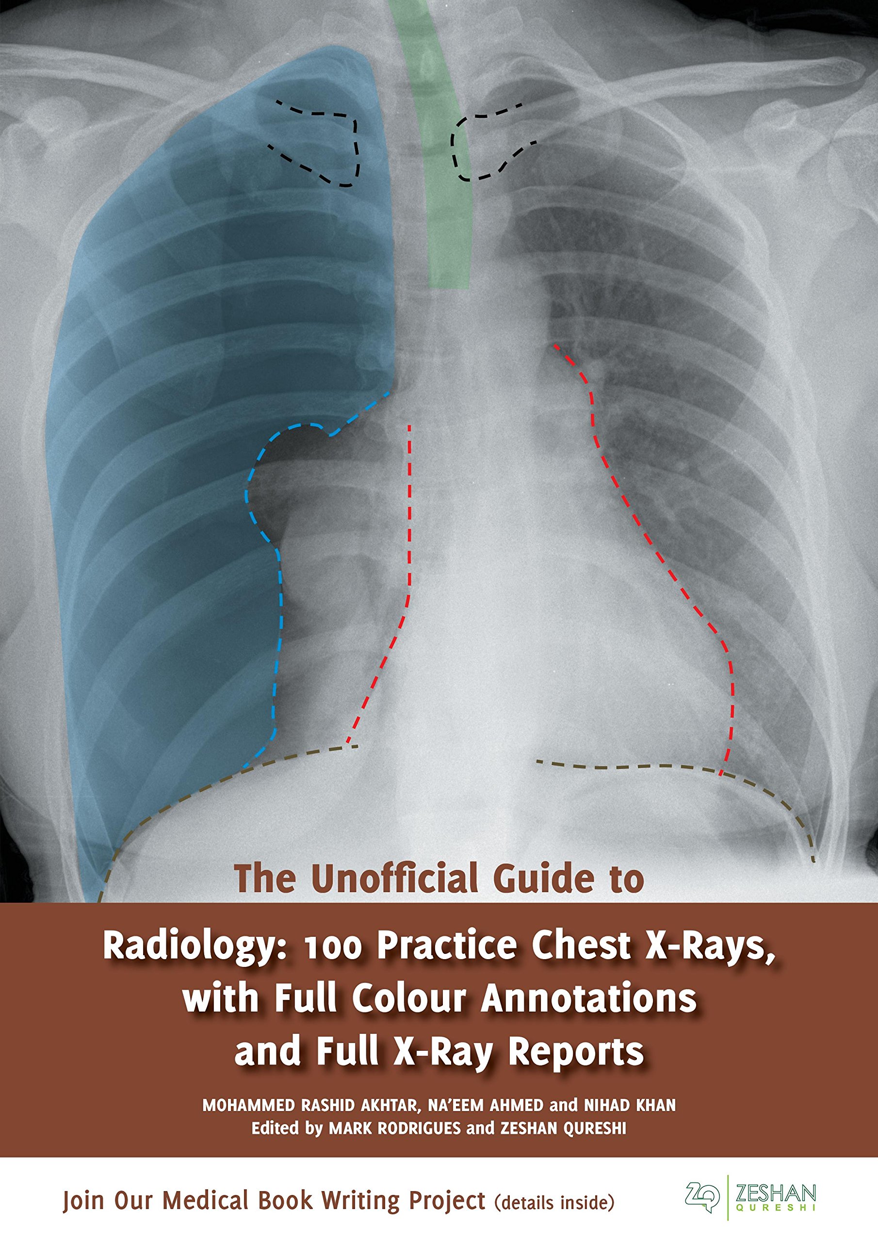 Mua The Unofficial Guide to Radiology: 100 Practice Chest X Rays with ...