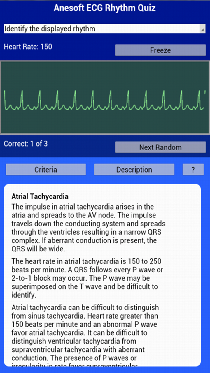 Amazon.com: ECG Rhythms Quiz : Apps & Games