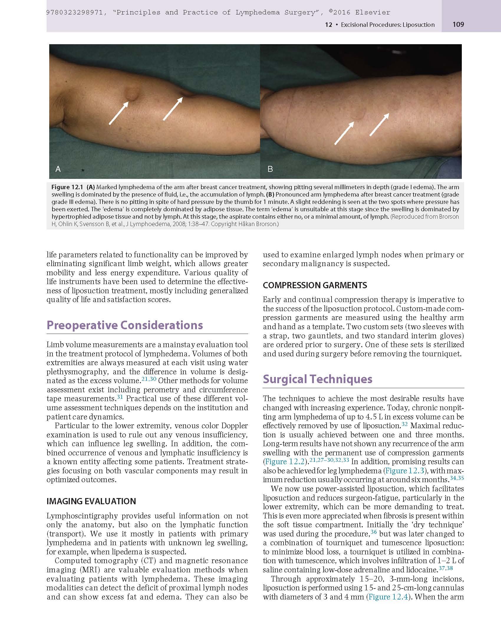 Principles and Practice of Lymphedema Surgery | Pricepulse