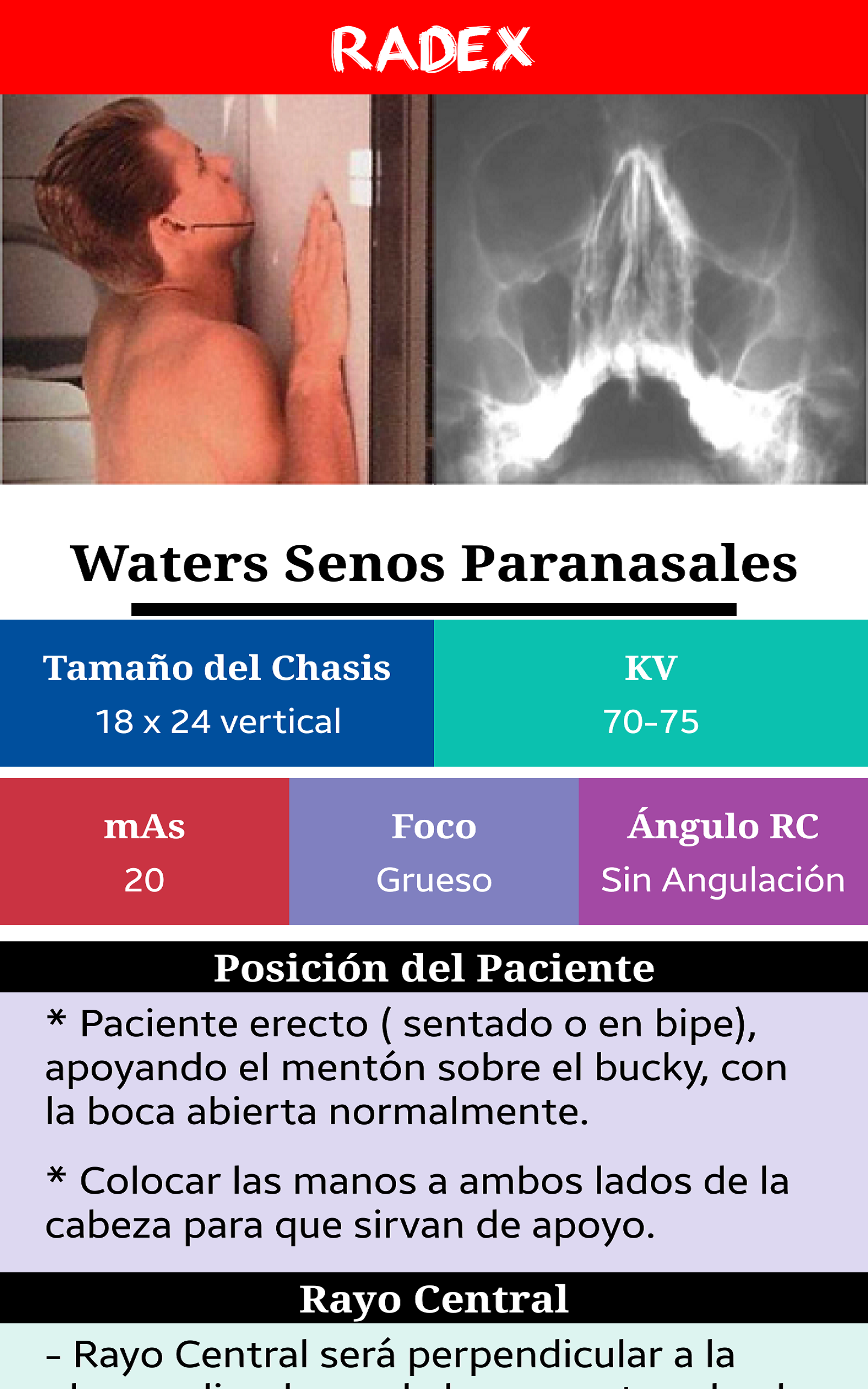 Radex: Amazon.es: Appstore para Android