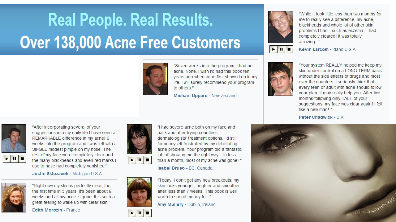 Amazon.com: Get Perfect Skin and Say No More to Acne - Get Rid of Acne ...