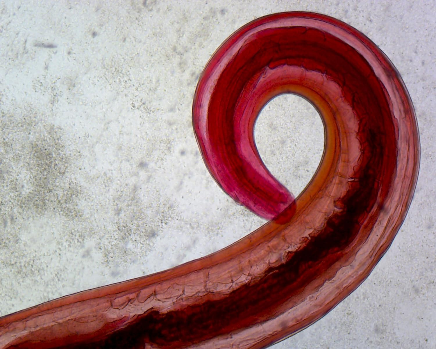 GSC International Enterobius Vermicularis (Pinworm) - Tobogán para ...