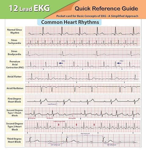 12 Lead EKG Pocket Card in Oman | Whizz Subjects