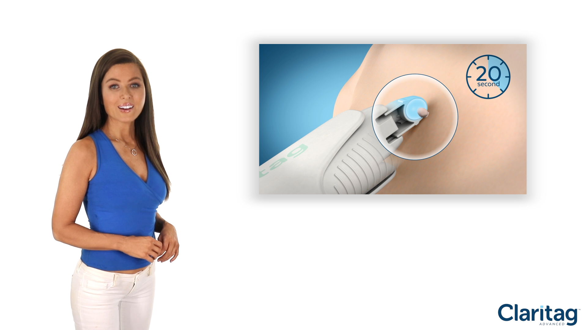 Watch The #1 Dermatologist Recommended Skin Tag Removal Device on ...