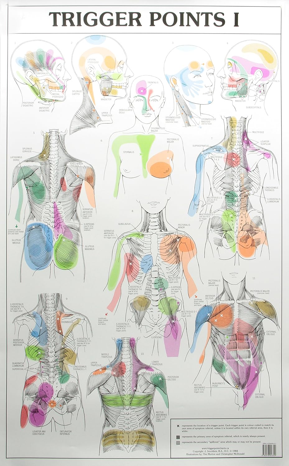 Amazon.com: Trigger Points I and II Laminated Chart/Posters: Industrial ...