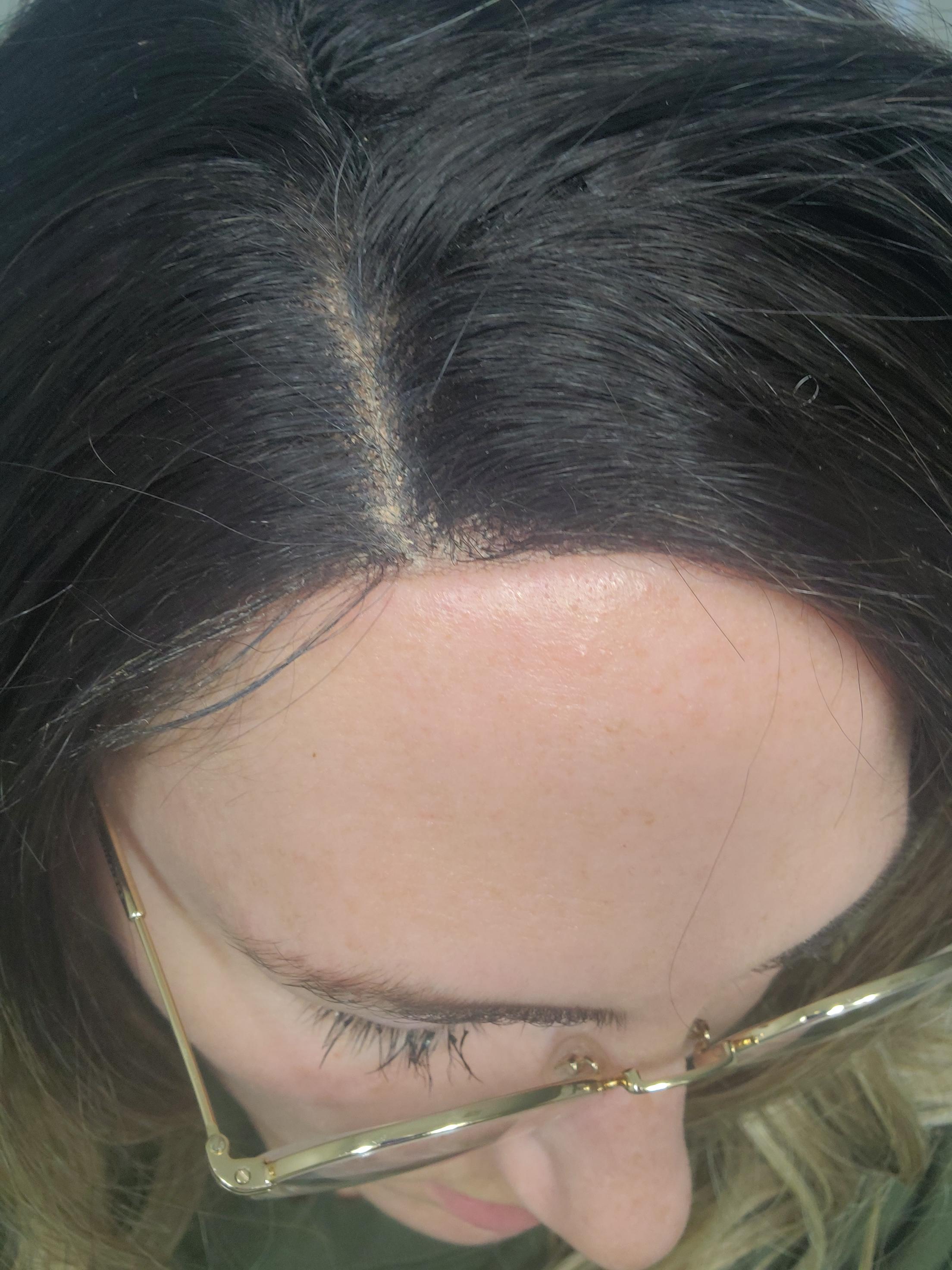 $7/mo - Finance Perfect Line Lace Wig Grids and Knots Concealer - MICH ...