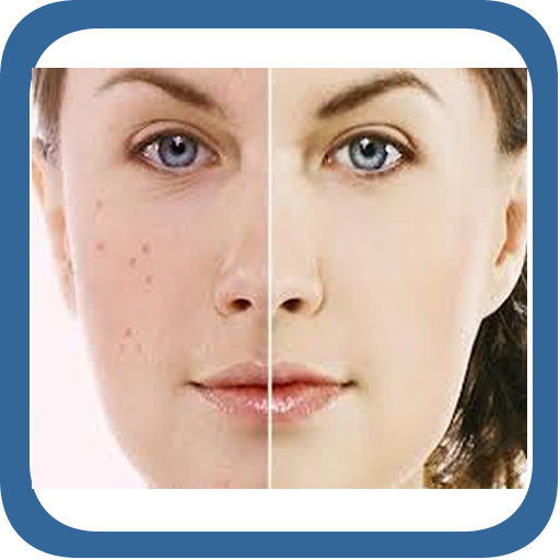 A-Z Acne:Amazon.com:Appstore for Android