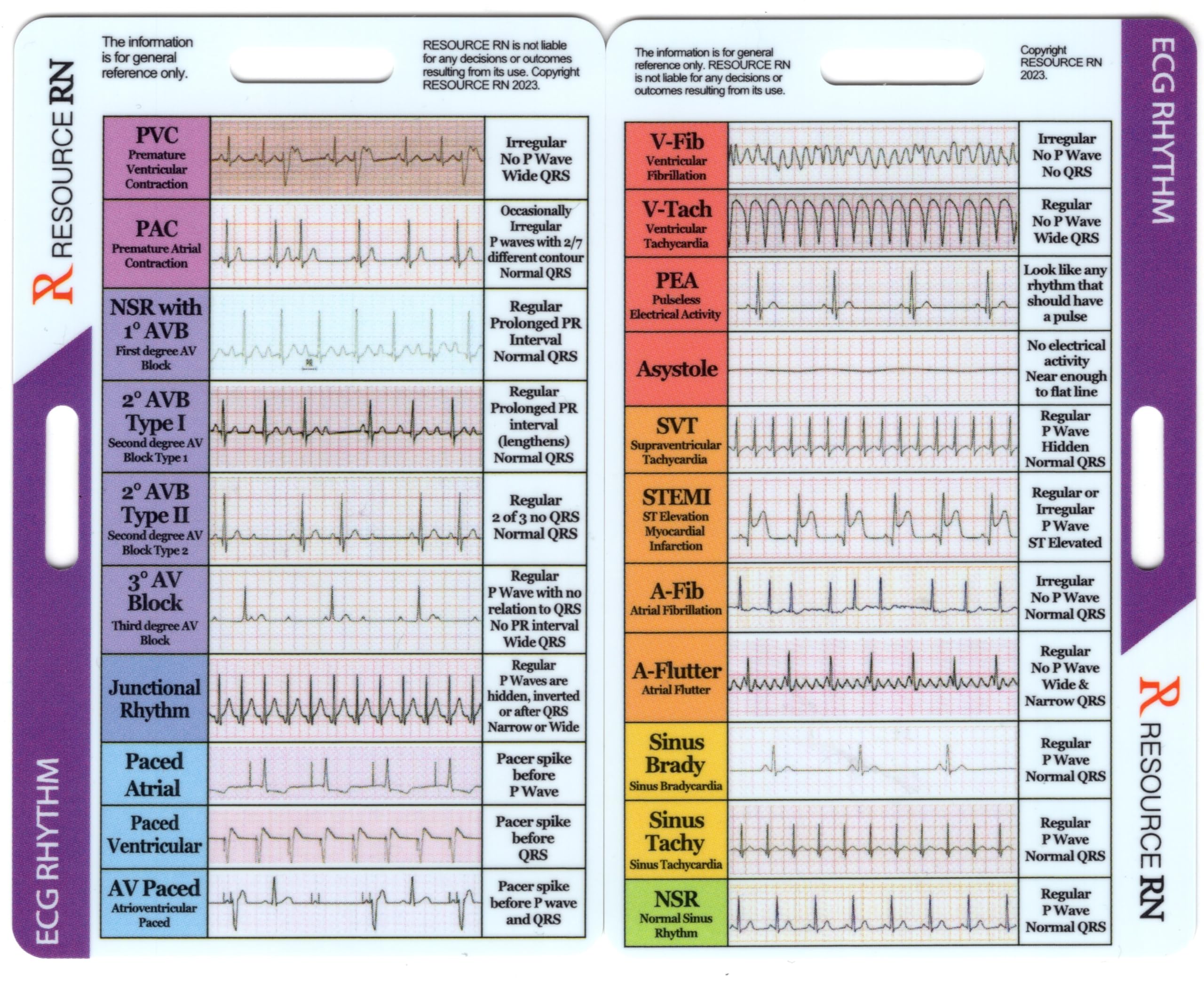Mua EKG Rhythm Interpretation - Compact & Portable Reference Card ...