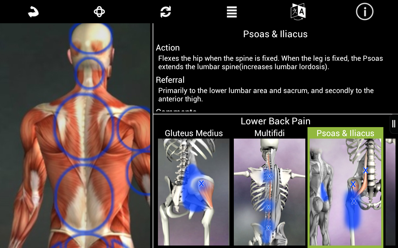 Muscle Trigger Point Anatomy:Amazon.com:Appstore for Android
