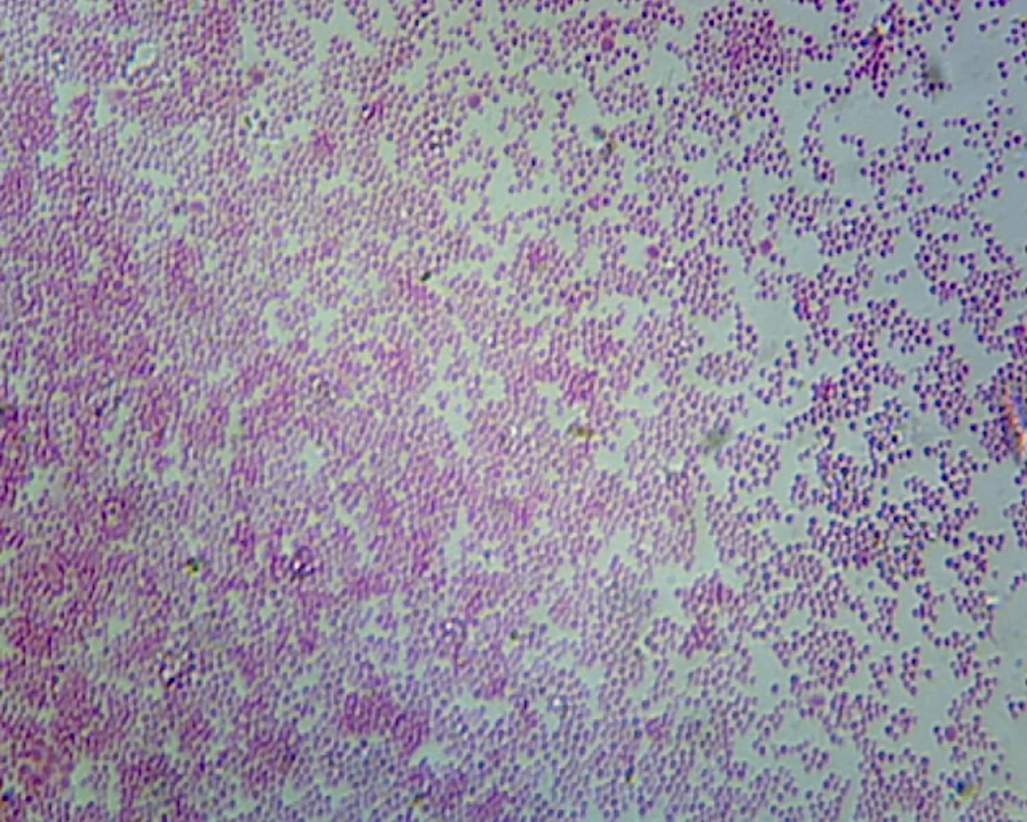 Escherichia Coli, Intestinal Flora - Microscope Slide: Amazon.com ...