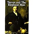 The Elephant Man And Other Reminiscences: Treves, Sir Frederick ...