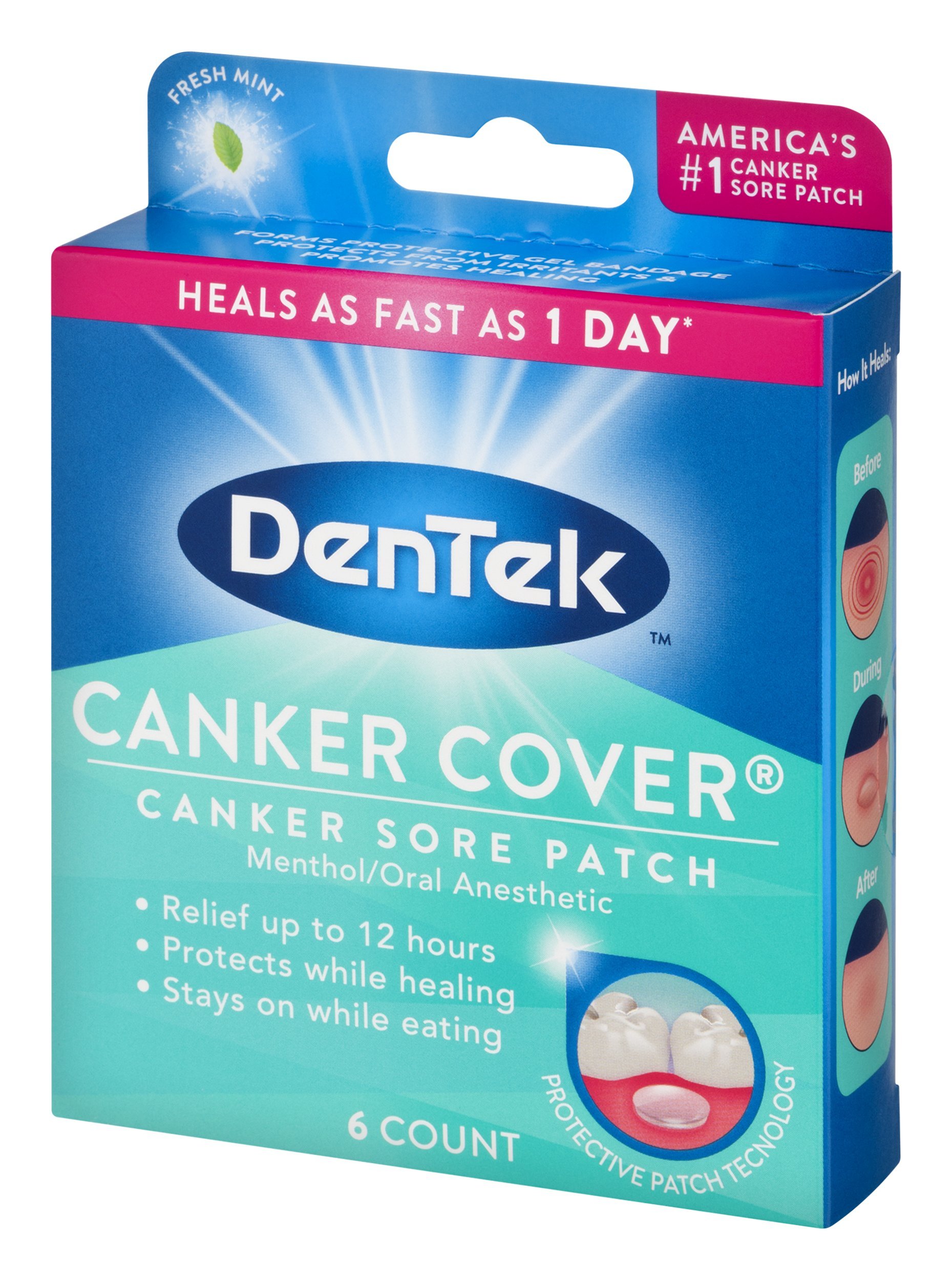 DenTek Canker Cover Patch | Canker Sore Relief up to 12 hours | 6 Count ...