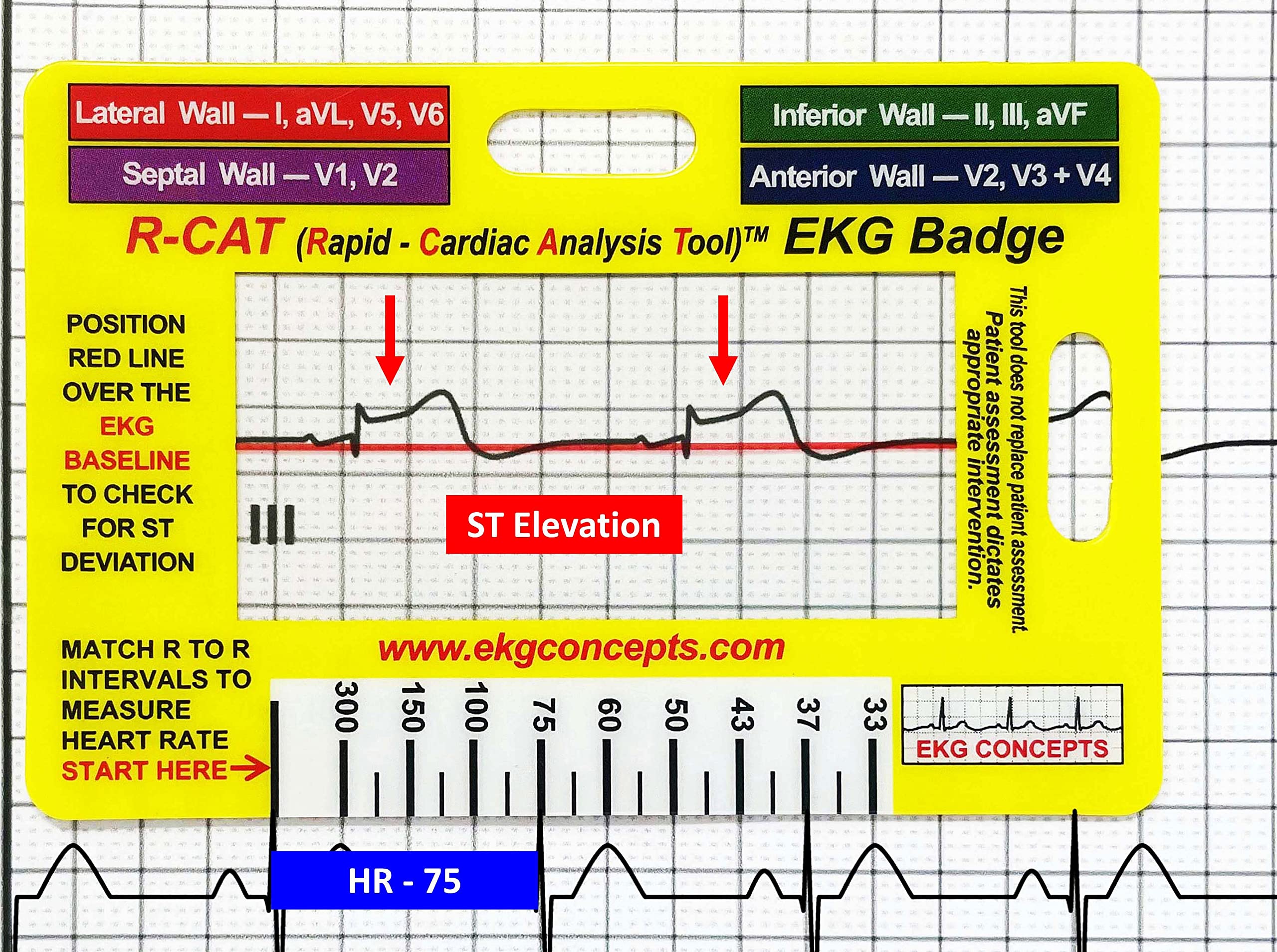 Mua R-CAT EKG Badge Card – Accurately Interpret ECG/EKG Rhythm Strips and 12 Lead EKG without ...