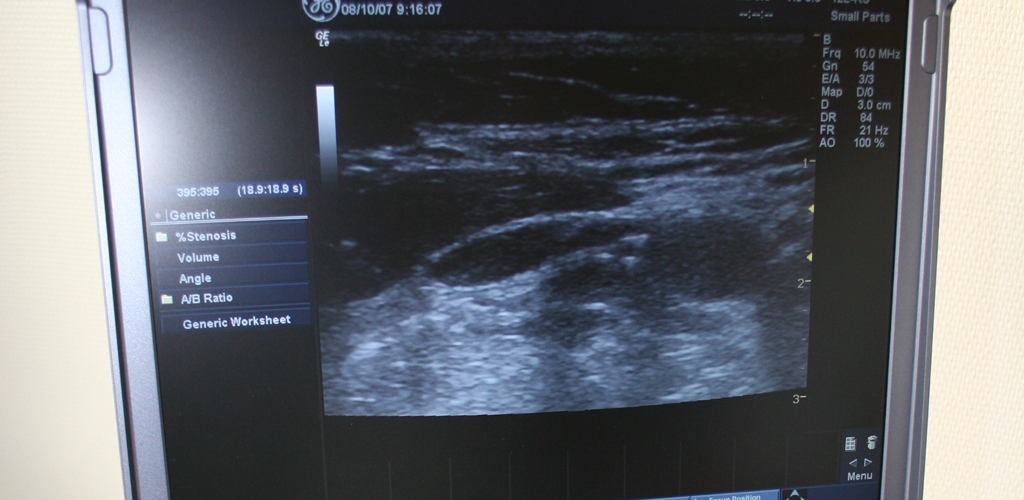 ARDMS Physics SPI Ultrasound Flashcards for ARDMS Physics Sonography ...