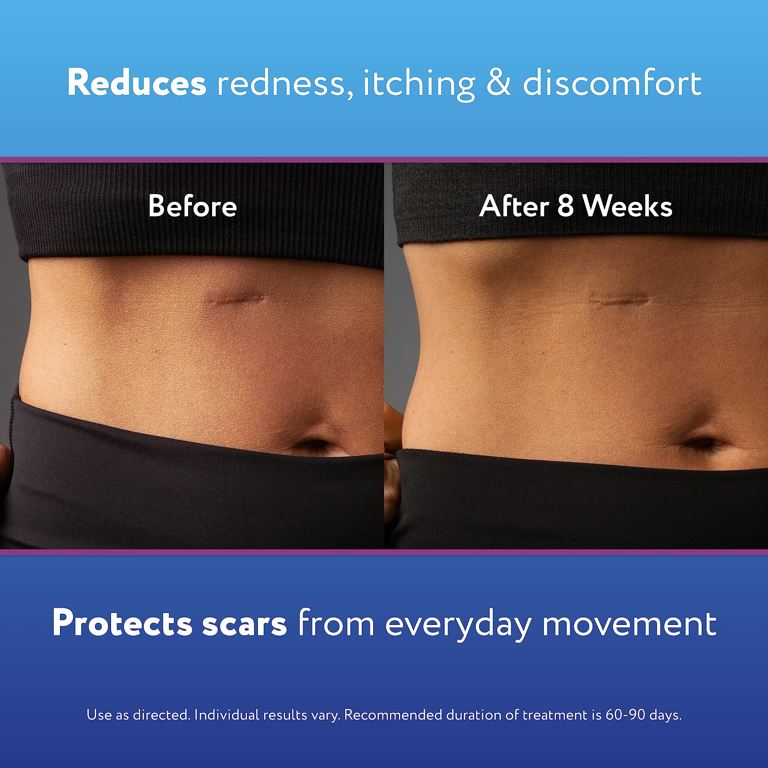 Mua ScarAway 100% Medical-Grade Silicone Scar Gel for Face, Body ...