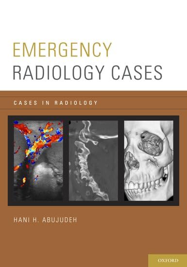Details for: Emergency radiology cases / › NGU Libraries catalog