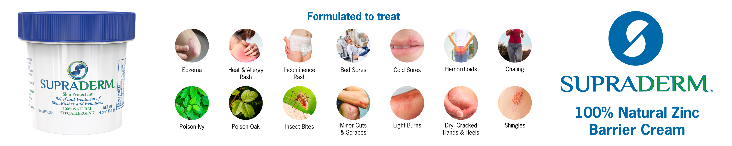 Amazon.ca: Supraderm