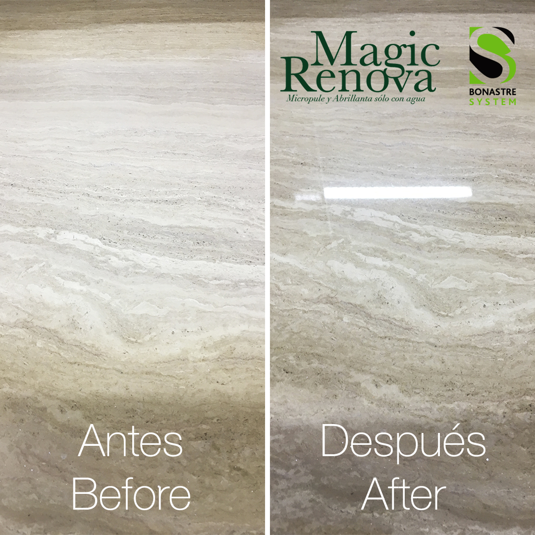 Amazon.es: Bonastre System : KIT PADS