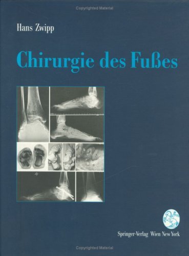 Chirurgie des Fußes by Hans Zwipp | Goodreads