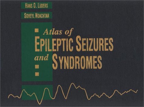Atlas of Epileptic Seizures and Syndromes, Text & CD-ROM by Hans O ...
