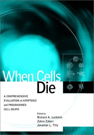 When Cells Die: A Comprehensive Evaluation of Apoptasis and Programmed ...